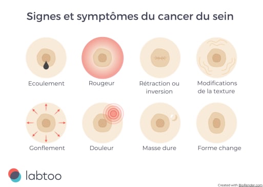 Le cancer du sein : les différents types et leurs traitements
