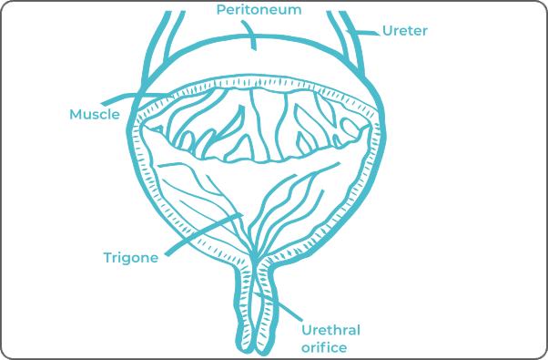 Bladder tumor samples for research | Labtoo