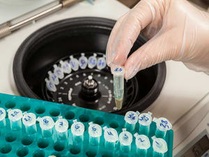 Purification de protéines à partir de cellules ou de lysats - Labtoo