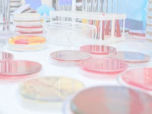 Antimicrobial synergy study – checkerboard assay - Bacteriology