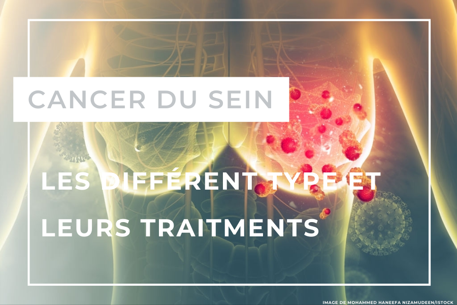 Le cancer du sein : les différents types et leurs traitements